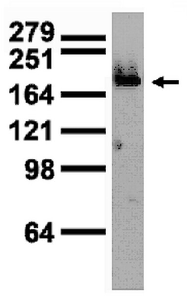 Anti-Sodium channel Nav1.7 Antibody, clone N68/6 | MABN41